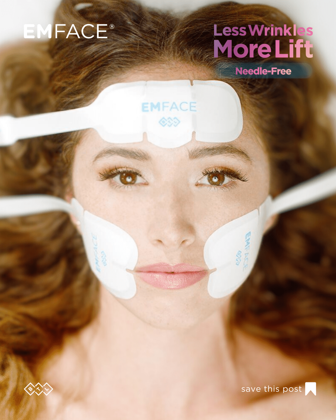BTL Emface Bournemouth | Non-Surgical Face Lift